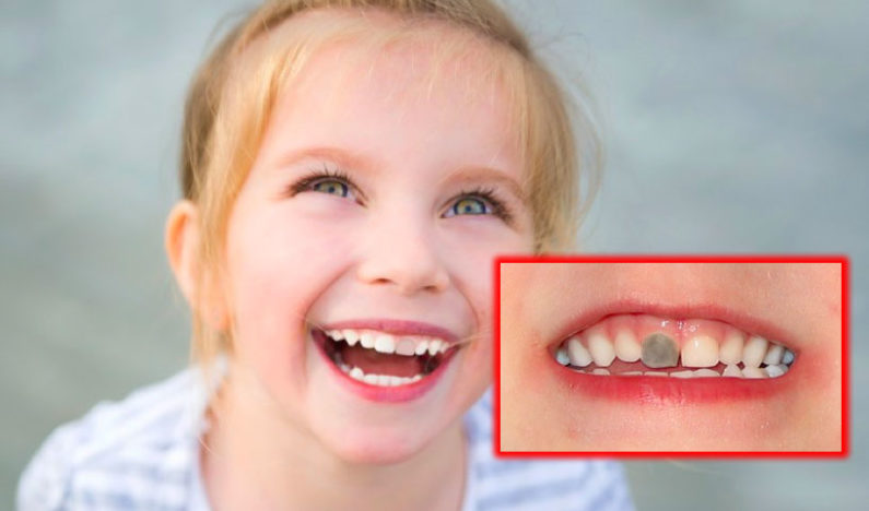 My Child's Tooth Is Dark! What Should I do? - Dr. Misee Harris